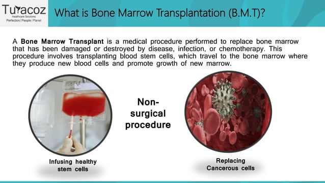 Bone marrow transplantation | PPT