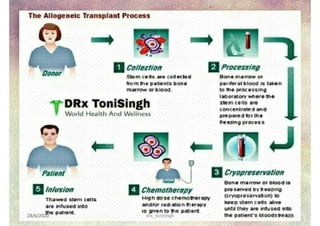 Bone marrow transplantation drx_tonisingh | PPT