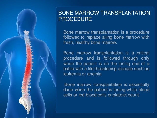 Bone marrow transplantation procedure
