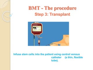 Bone marrow transplant by s,kabiraj | PPTX