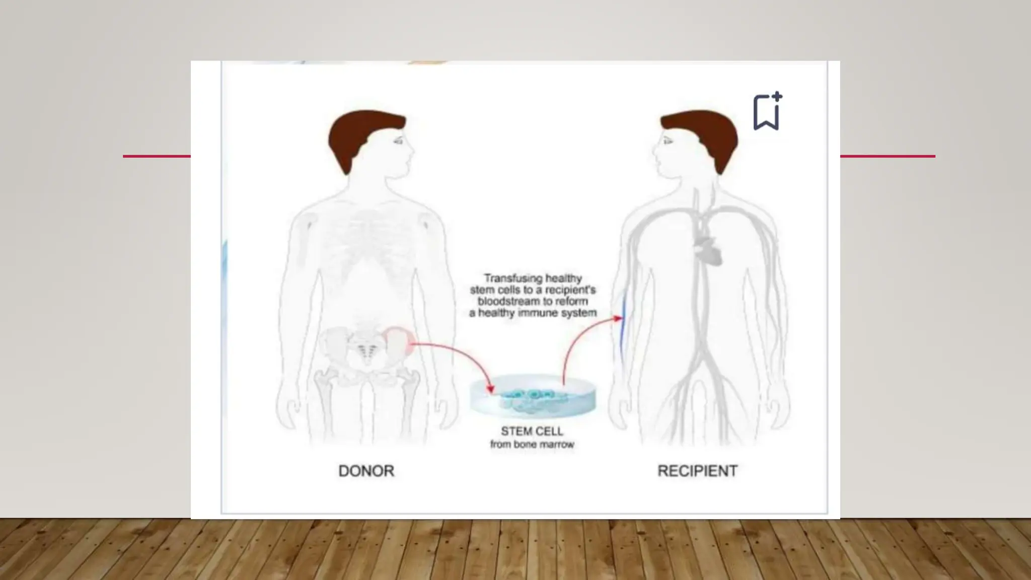 #bone marrow transplant procedure # pptx | PPTX