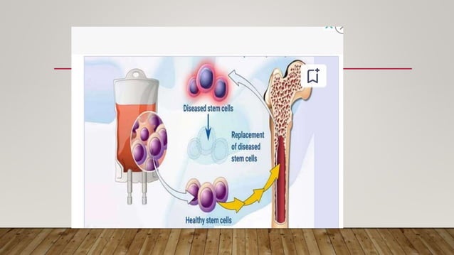 #bone marrow transplant procedure # pptx | PPTX