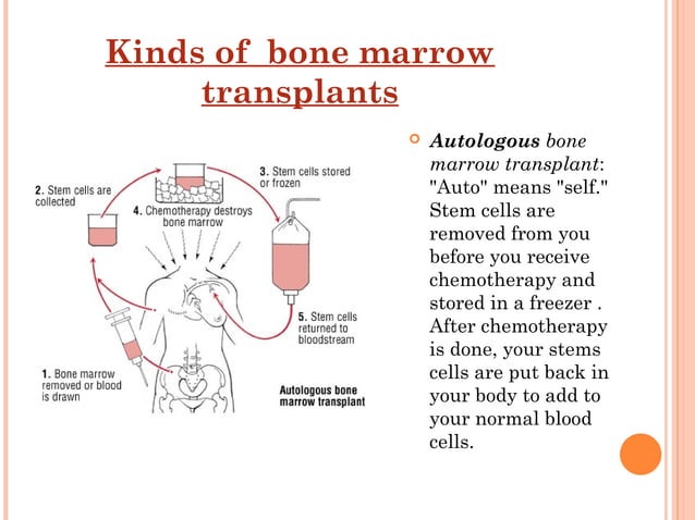 Bone Marrow | PPT