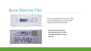 BONE MARROW sample processing, staining . | PPTX
