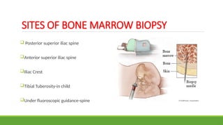 BONE MARROW sample processing, staining . | PPTX
