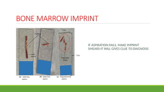 BONE MARROW sample processing, staining . | PPTX