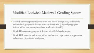 Bone Metastasis- Part 1.pptx