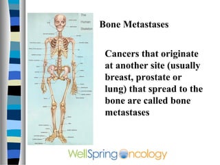 Bone mets video | PPT