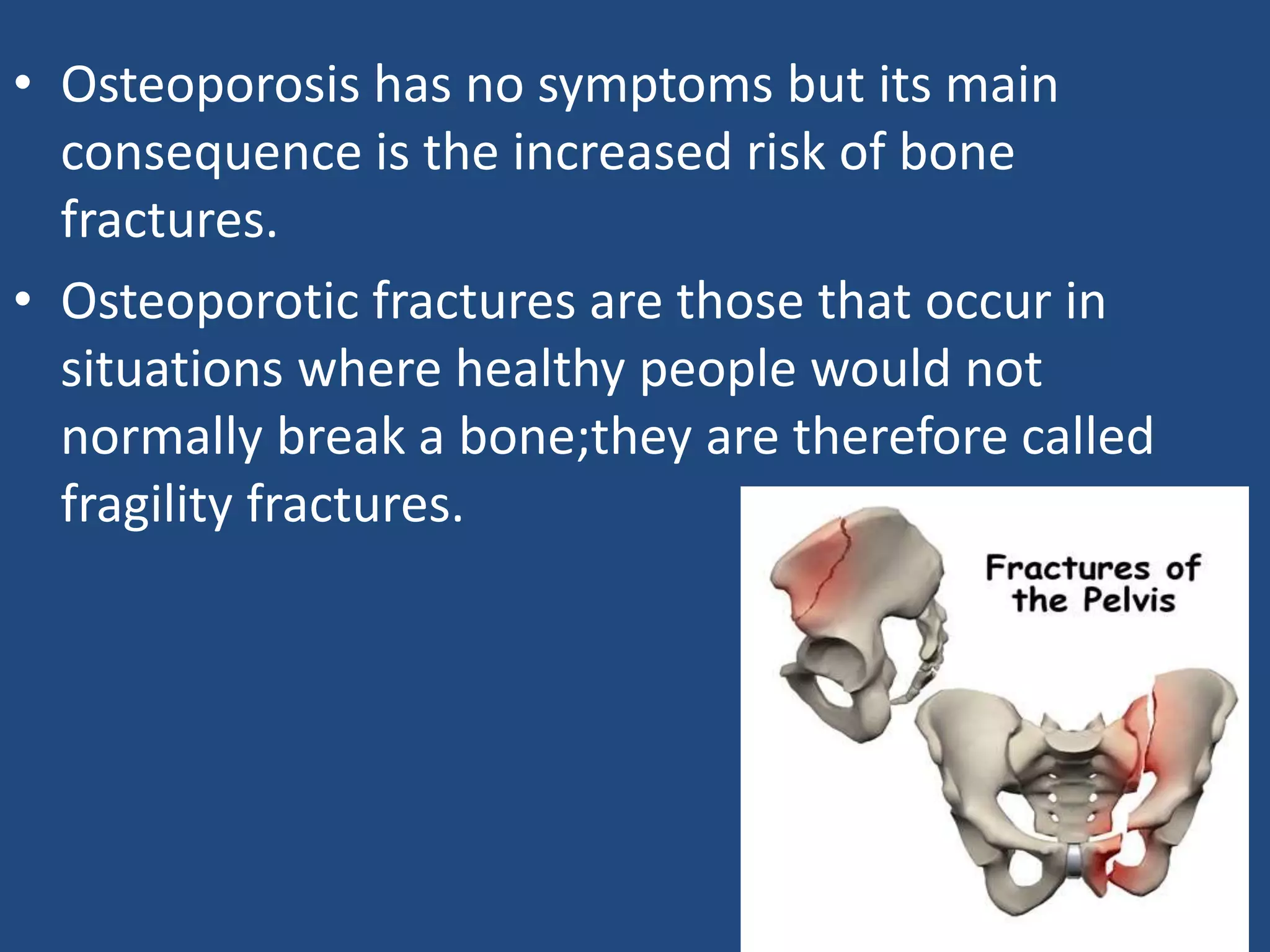 Bone mineral density (bmd) test | PPTX