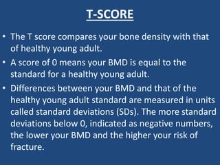 Bone mineral density (bmd) test | PPTX