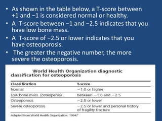 Bone mineral density (bmd) test | PPTX