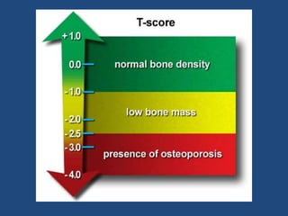 Bone mineral density (bmd) test | PPTX