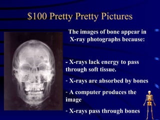 Bone Muscle Skin Jeopardy | PPT