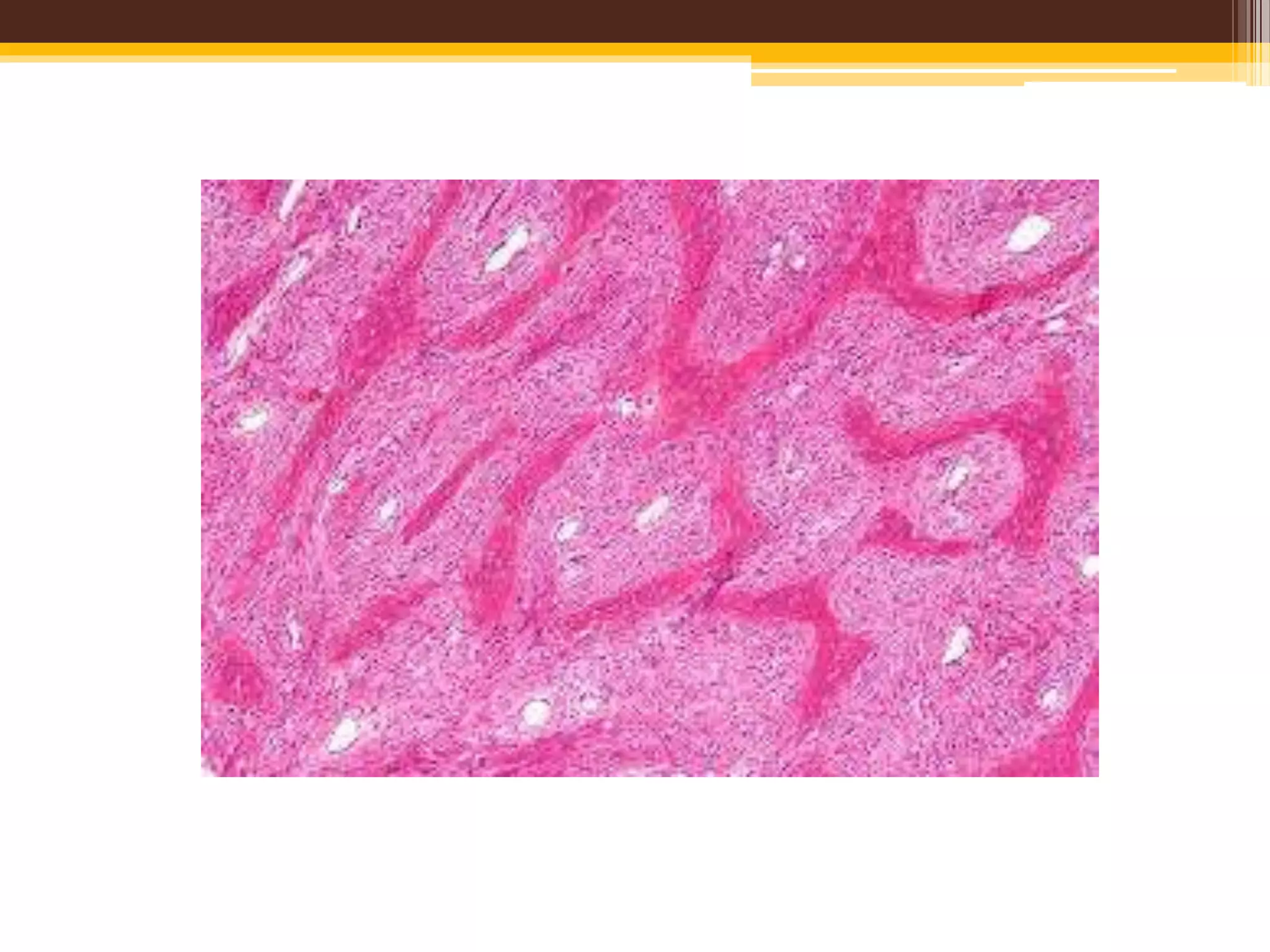 Bone pathology | PPTX