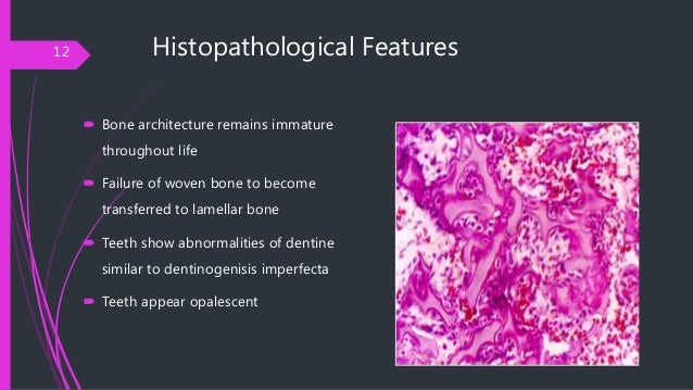 Bone Pathology