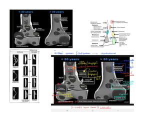 Bone pathology summary for undergraduate | PPT