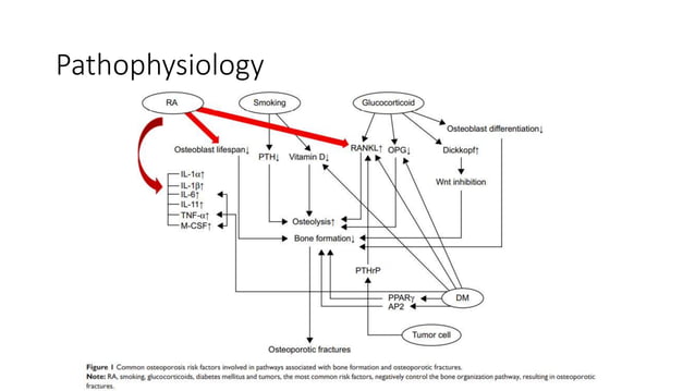 Bone physiology, OSTEOPOROSIS, Pagets Disease, Hyperparathyoidism | PPTX