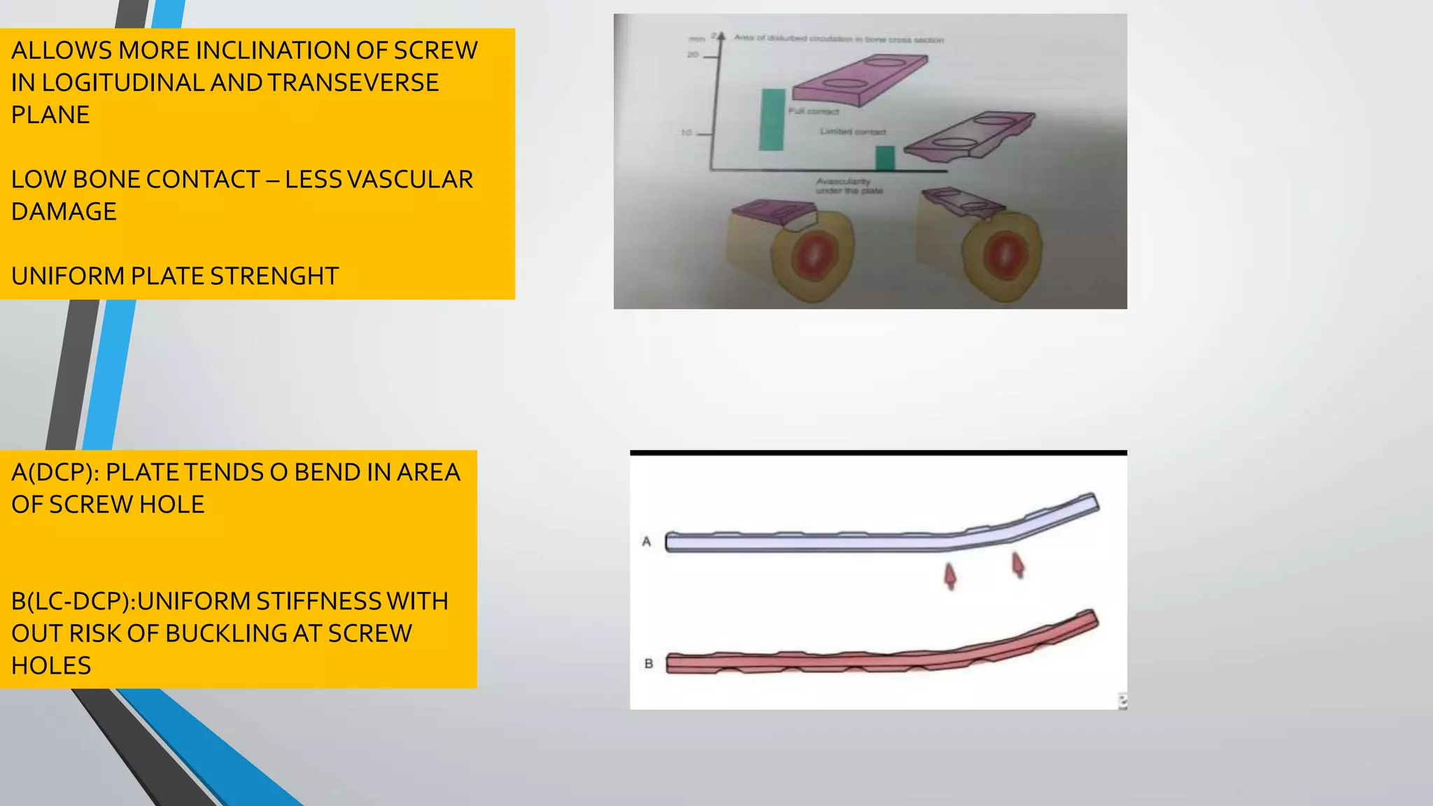 ORTHOPEDIC BONE PLATE | PPTX