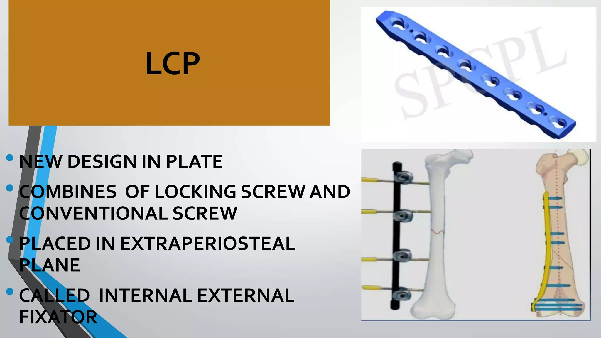 ORTHOPEDIC BONE PLATE | PPTX