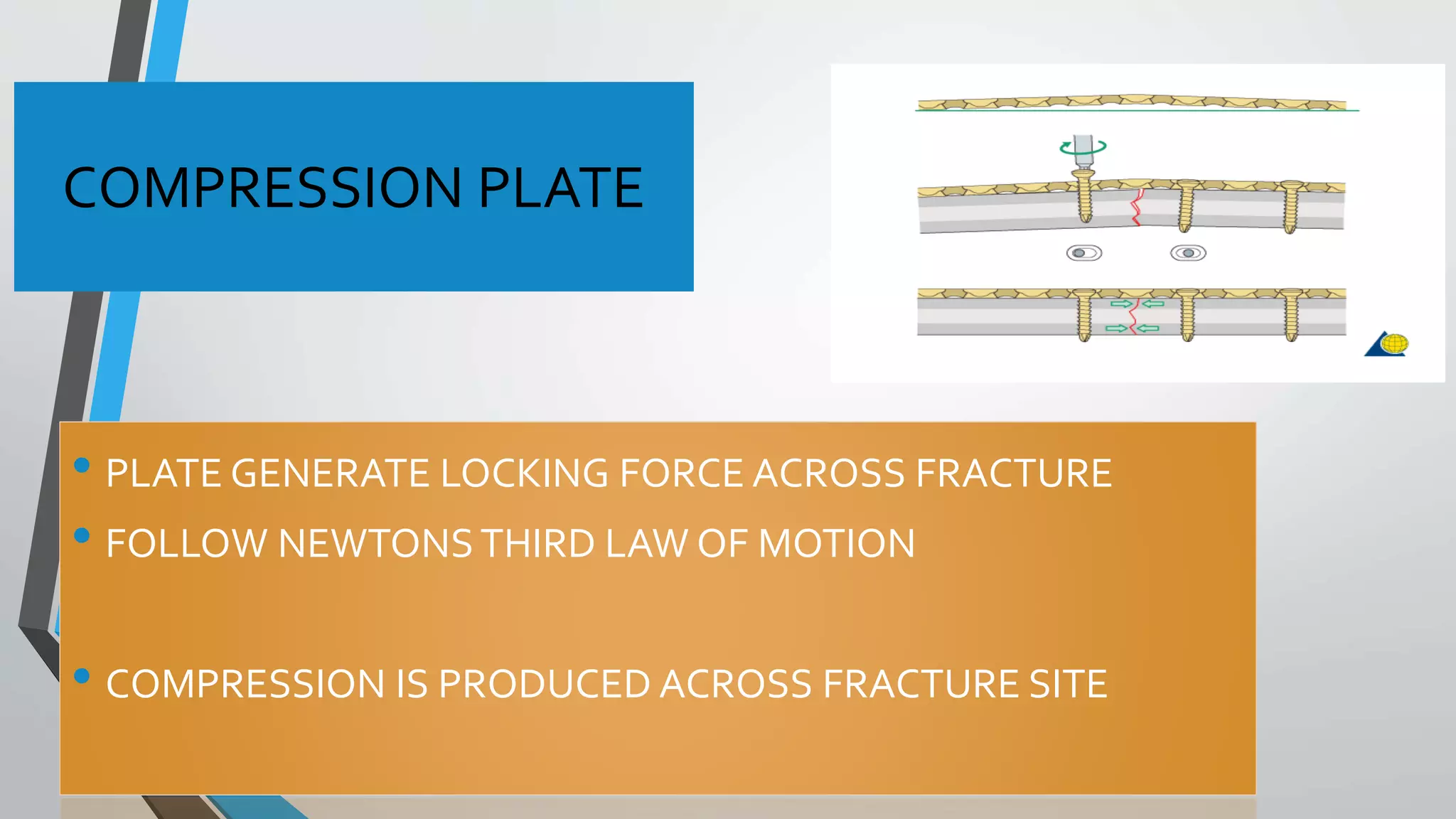ORTHOPEDIC BONE PLATE | PPTX