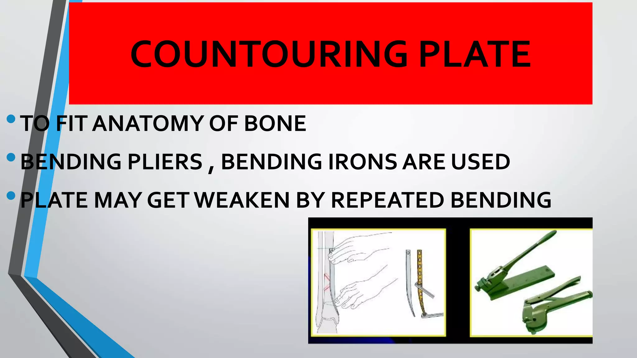 ORTHOPEDIC BONE PLATE | PPTX