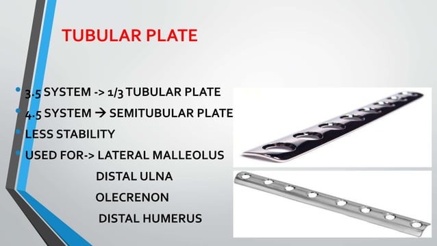 ORTHOPEDIC BONE PLATE | PPTX