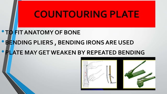 ORTHOPEDIC BONE PLATE | PPTX