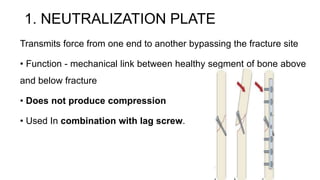 BONE PLATES ORTHOPEDIC SEMINAR AIIMS JODHPUR | PPTX