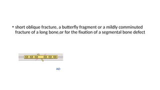 Bone Plates modalities (1).pptx for residents | PPT