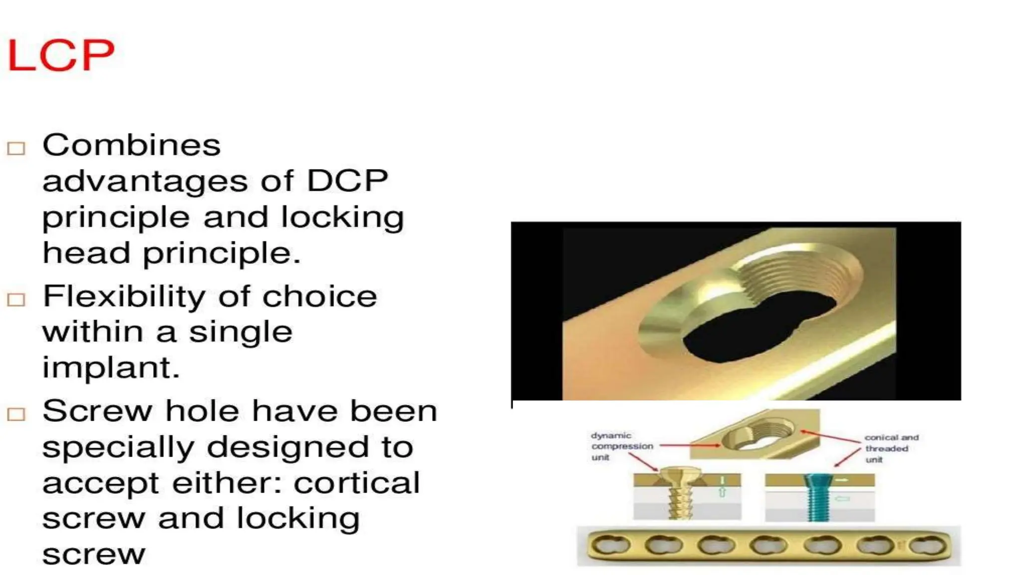 BONE PLATING USES AND COMPLICATION ORTHOPAEDICS PPT | PPTX