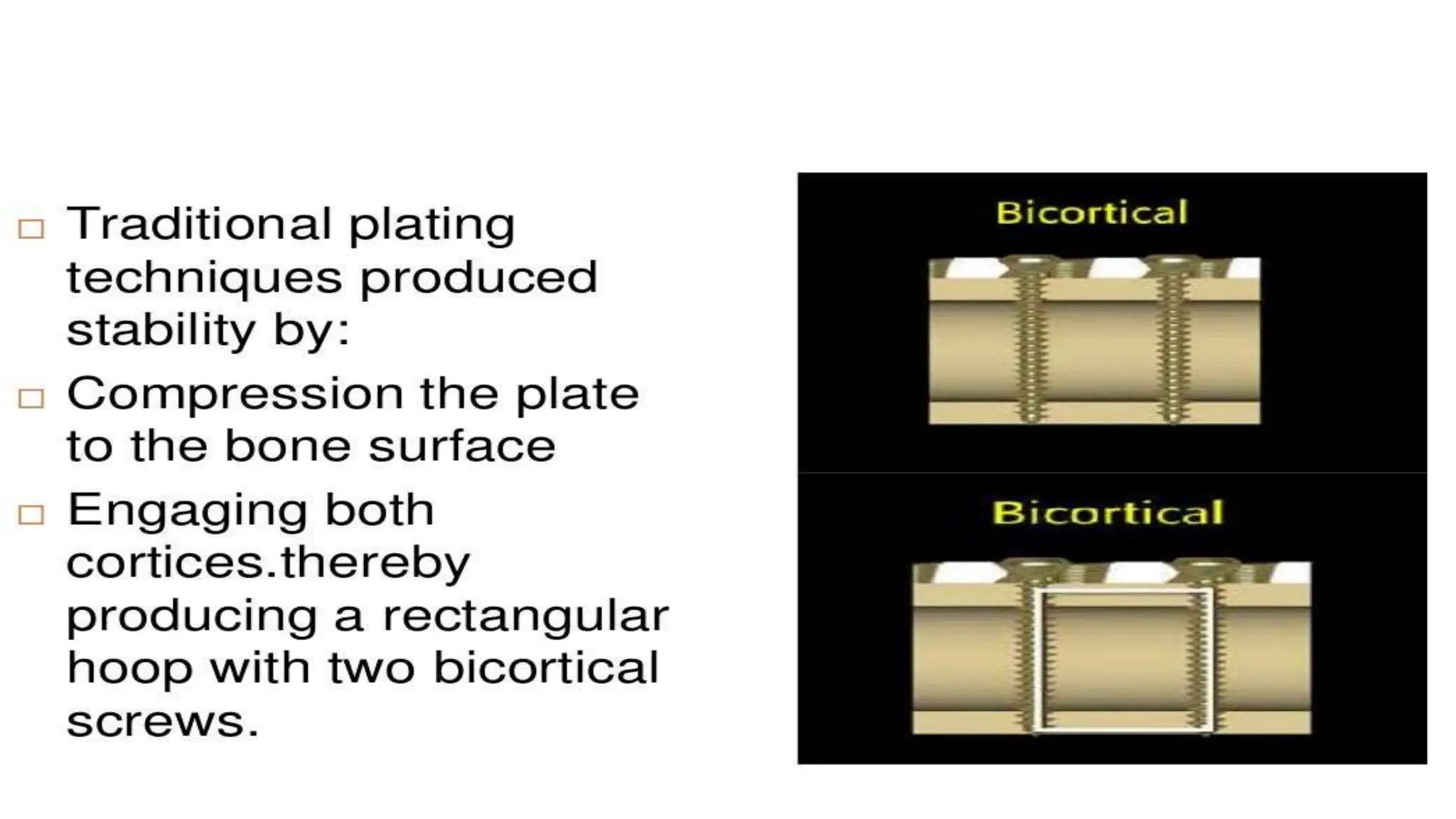 BONE PLATING USES AND COMPLICATION ORTHOPAEDICS PPT | PPTX
