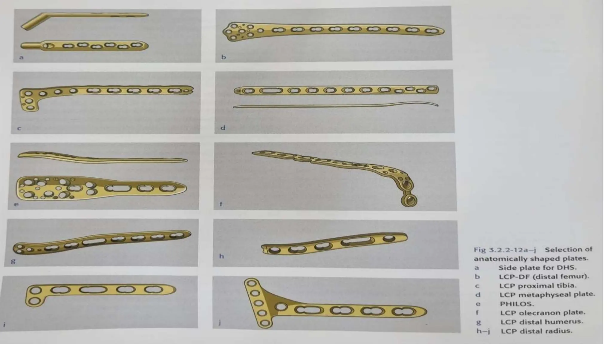 BONE PLATING USES AND COMPLICATION ORTHOPAEDICS PPT | PPTX