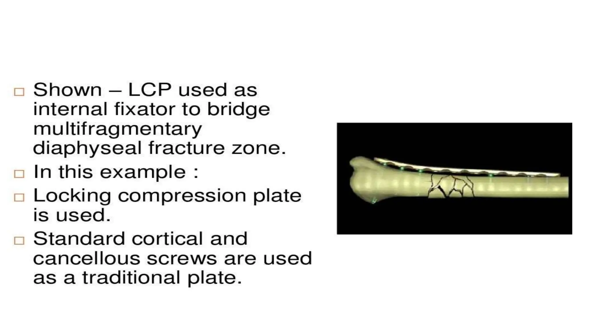 BONE PLATING USES AND COMPLICATION ORTHOPAEDICS PPT | PPTX