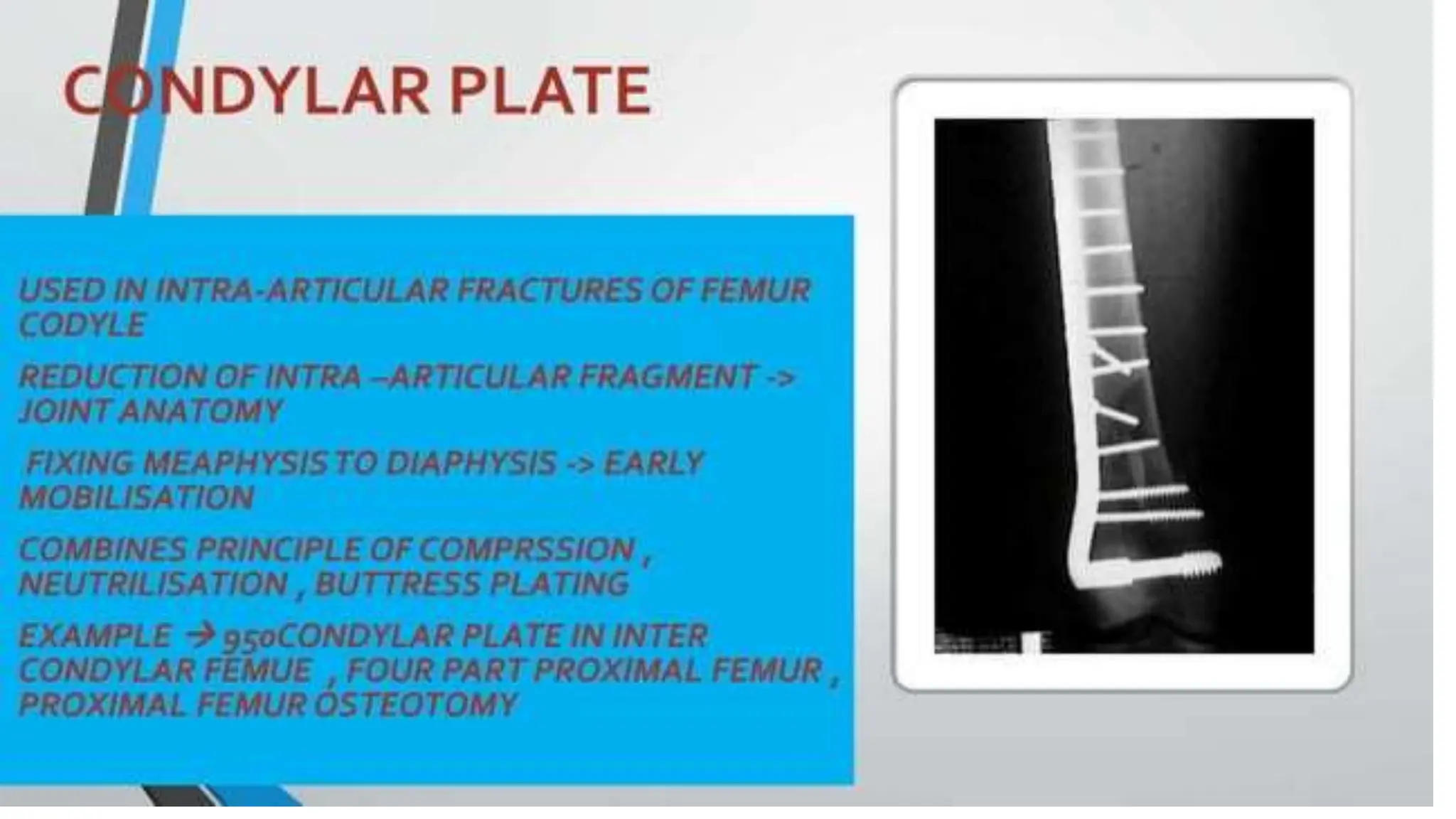 BONE PLATING USES AND COMPLICATION ORTHOPAEDICS PPT | PPTX