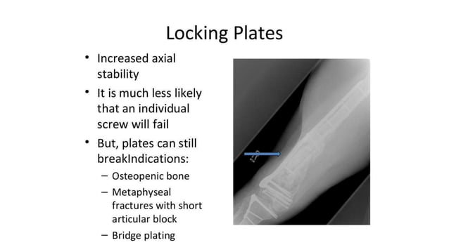 BONE PLATING USES AND COMPLICATION ORTHOPAEDICS PPT | PPTX | Death ...