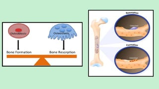 bone presentation.pptx