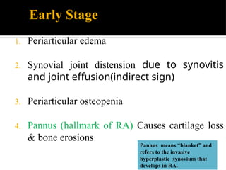 Radiological Interpretation of common bone Diseases | PPTX