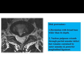 Radiological Interpretation of common bone Diseases | PPTX
