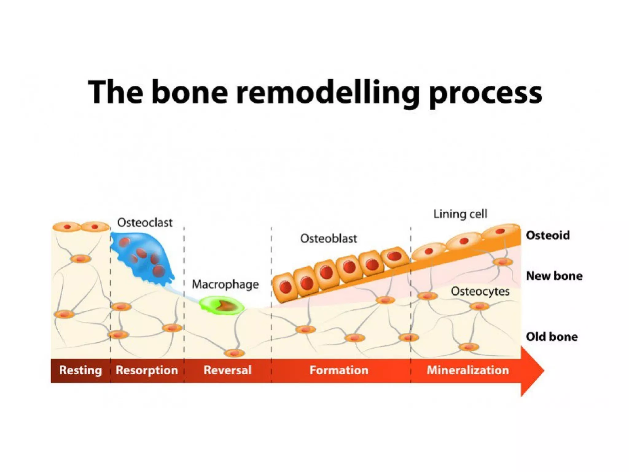 Bone regeneration and substitutes | PPT