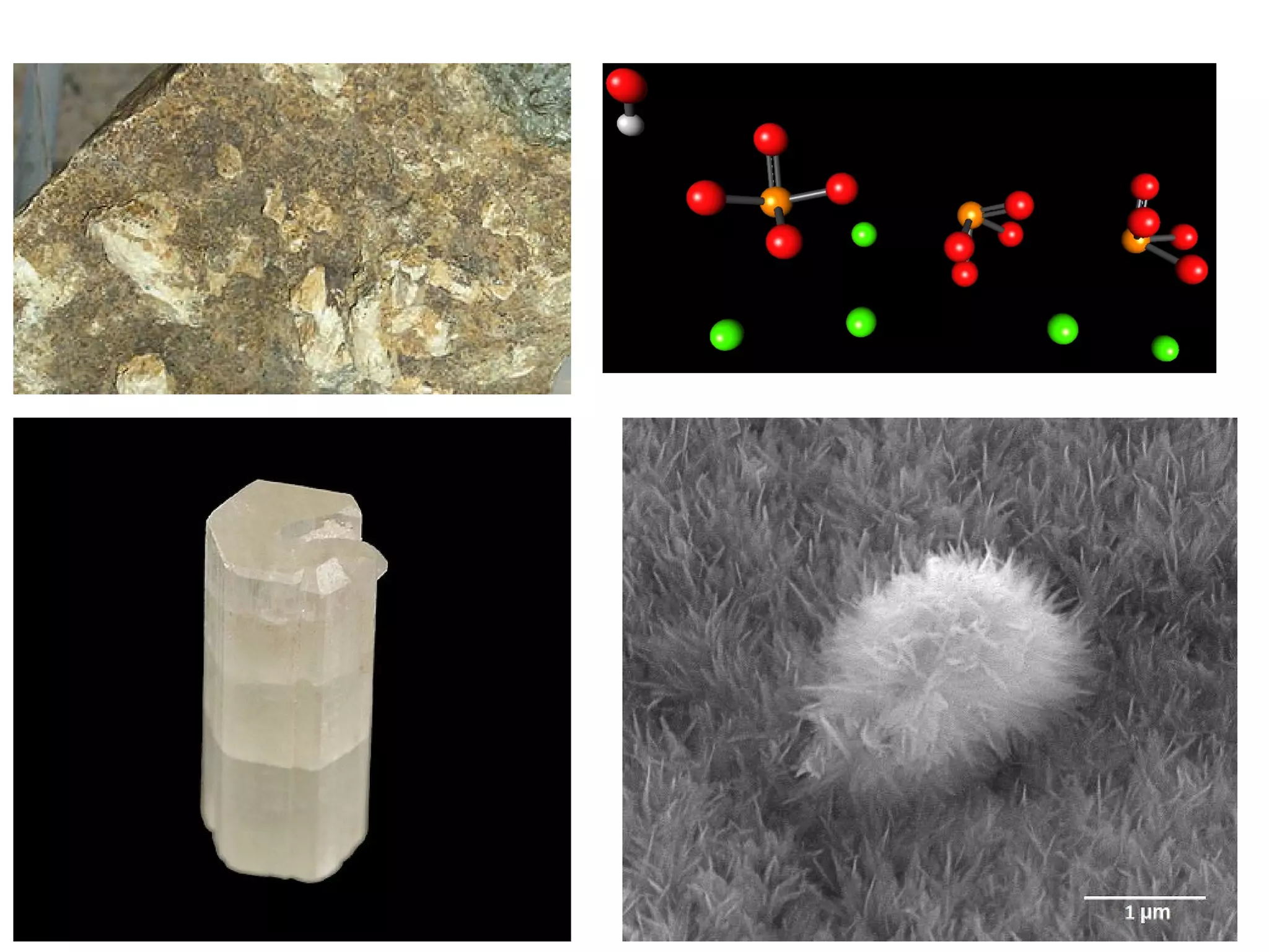 Bone regeneration and substitutes | PPT