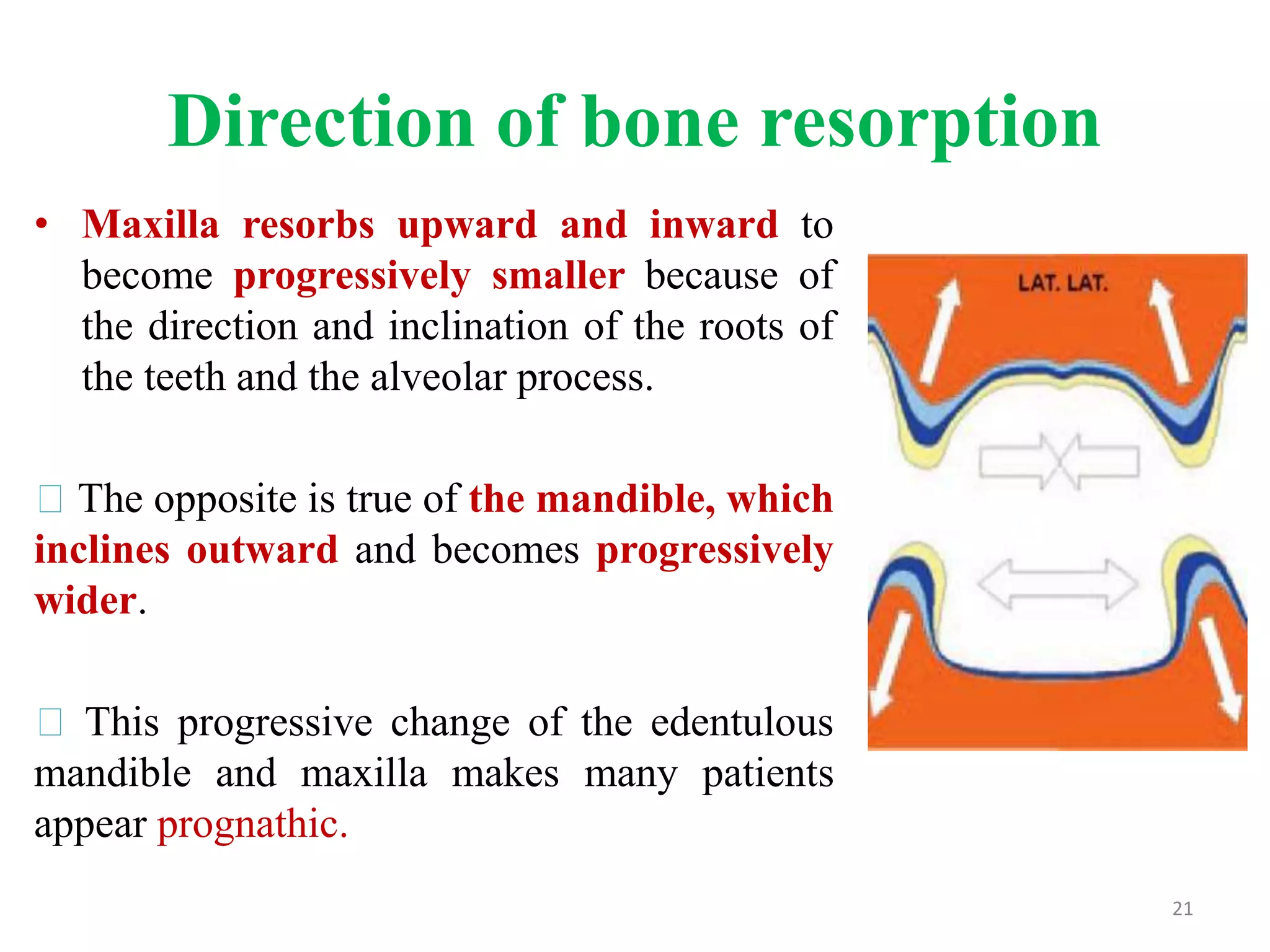 Bone Resorption Pattern.pptx