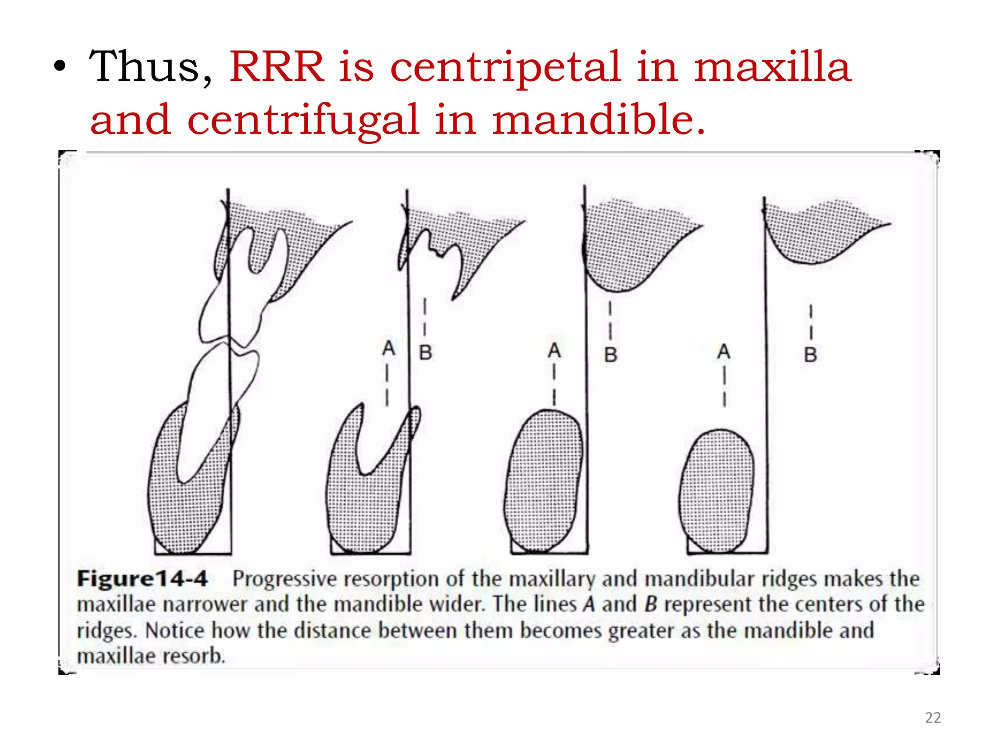 Bone Resorption Pattern.pptx