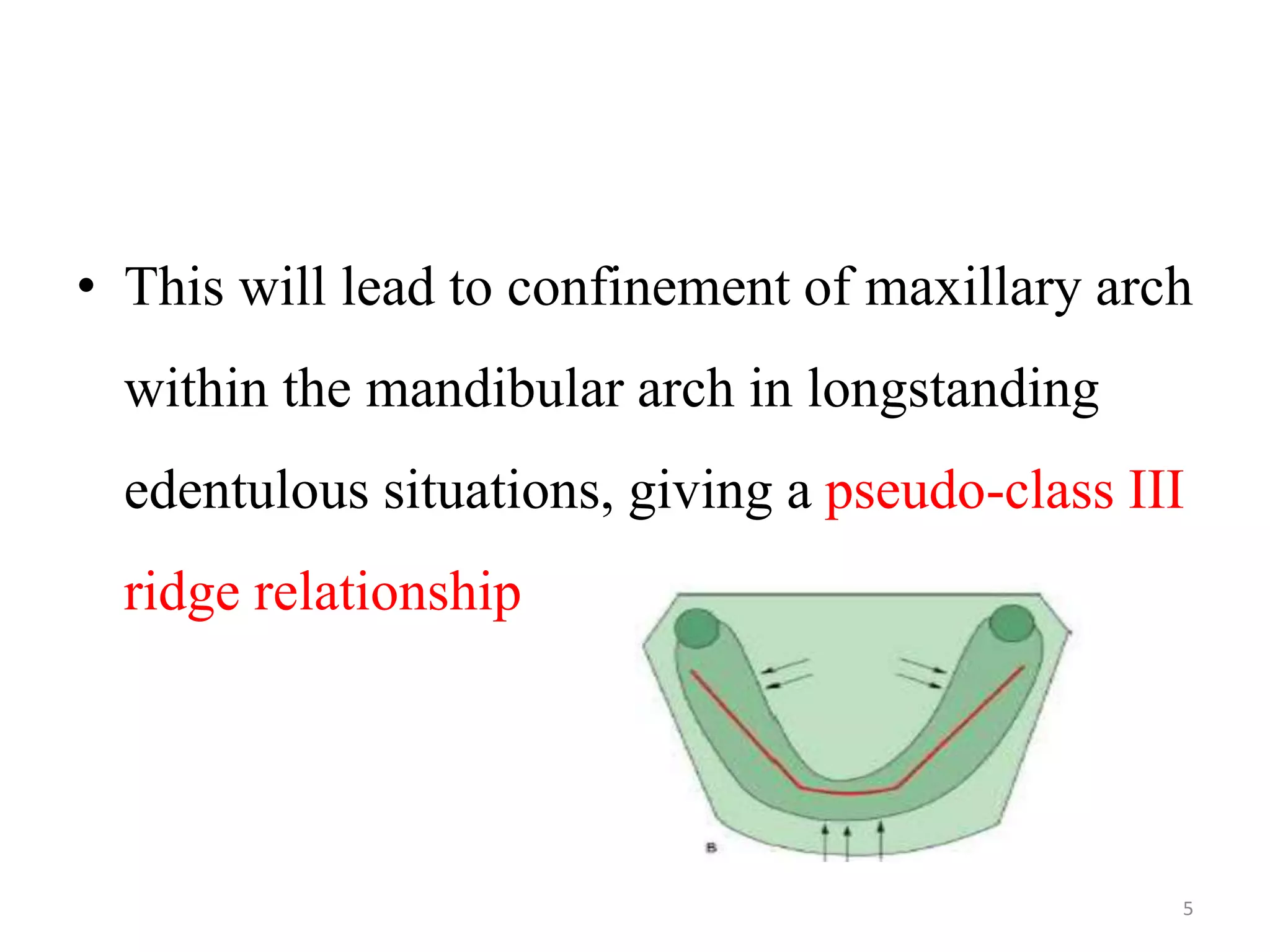 Bone Resorption Pattern.pptx