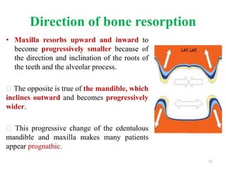 Bone Resorption Pattern.pptx