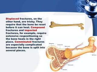 Bones | PPTX