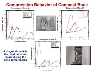 Bones 011910 | PPT