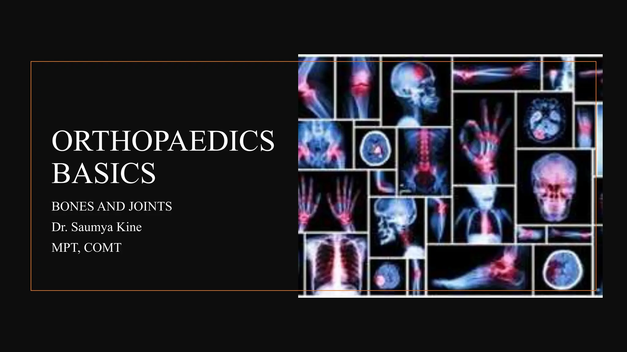 Orthopaedics basics (Bones and Joints Basics).pptx