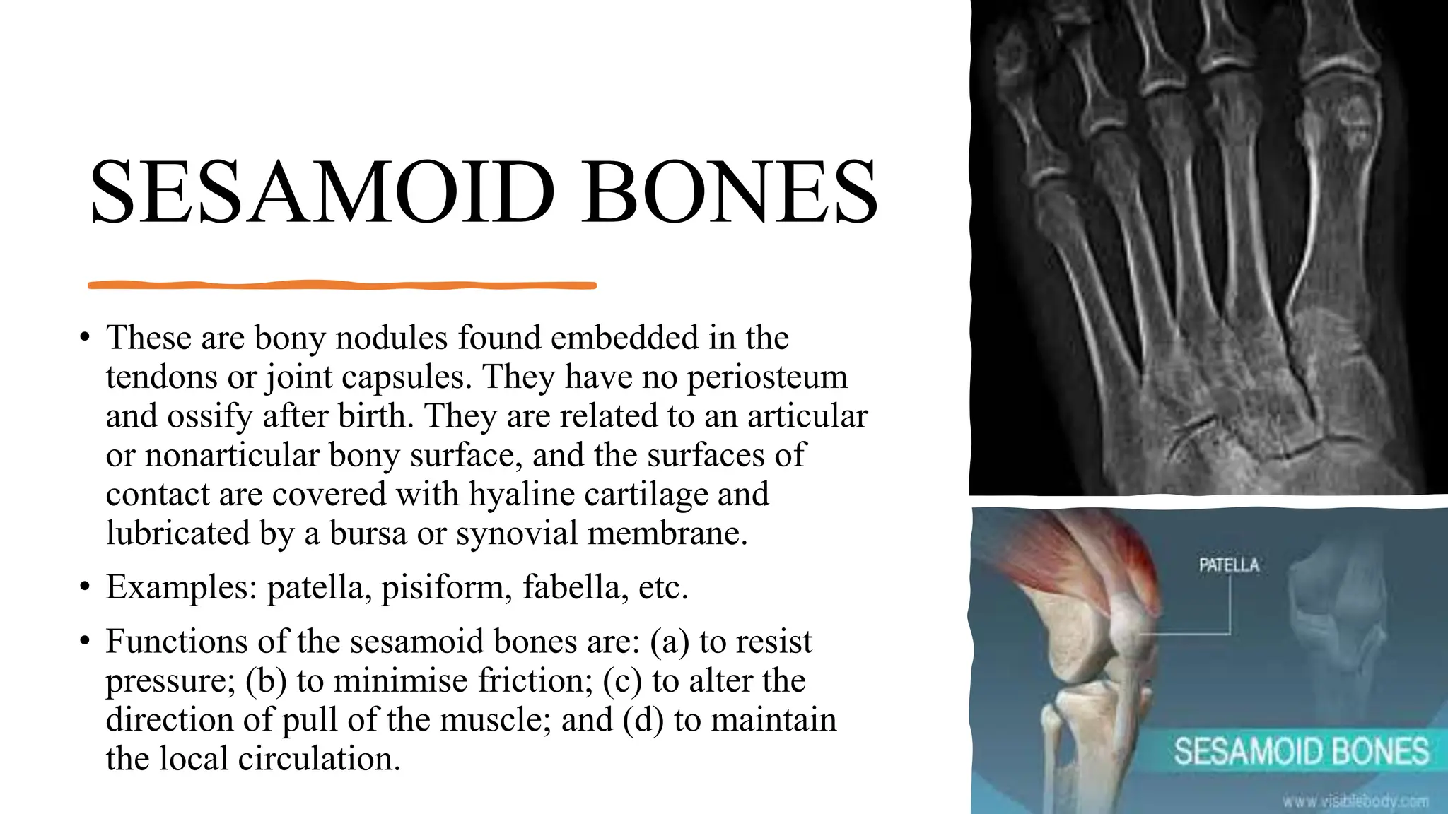 Orthopaedics basics (Bones and Joints Basics).pptx