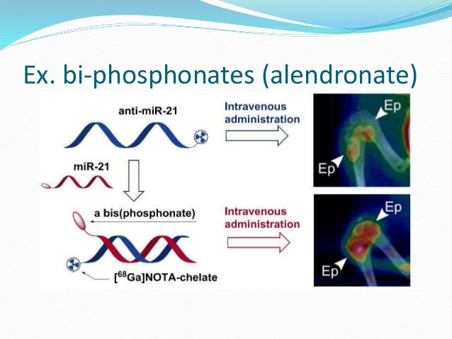 Bone targeting delivery system