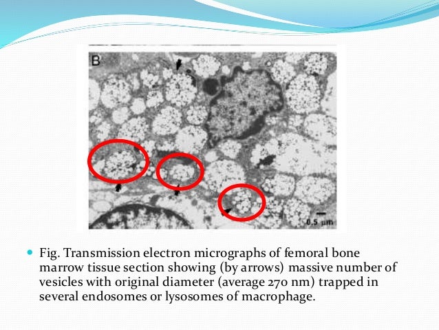 Bone targeting delivery system